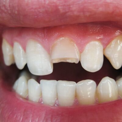 Family Dentist Hamilton, New Zealand | Tulip Dental
